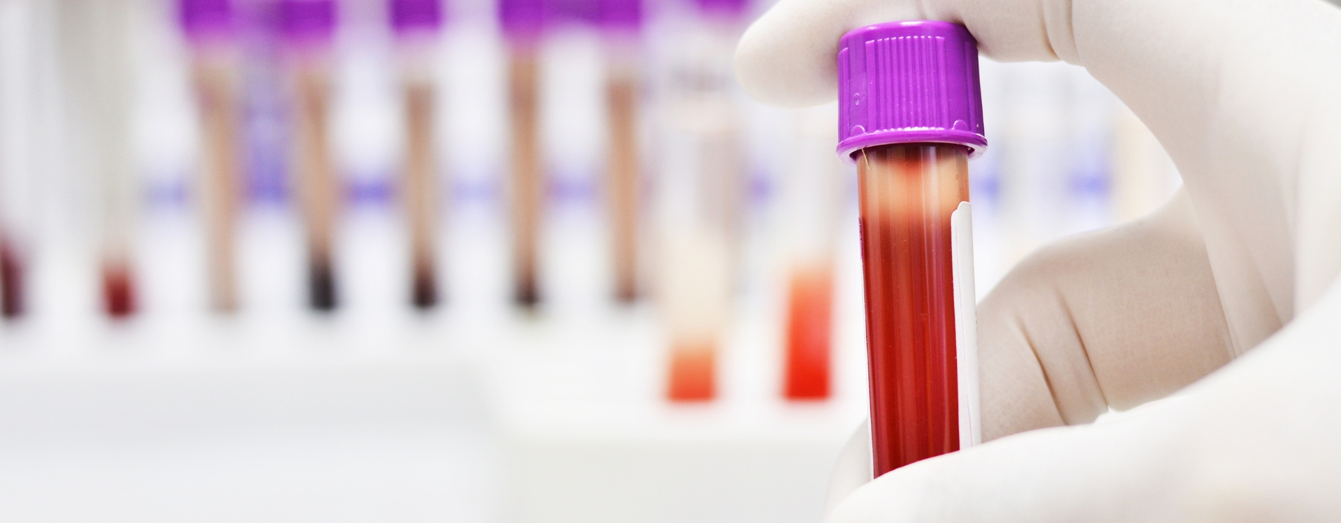 Laboratory - Prospect OBGYN